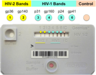 Question 3 - HIV-2 Infection Question Bank - National HIV Curriculum